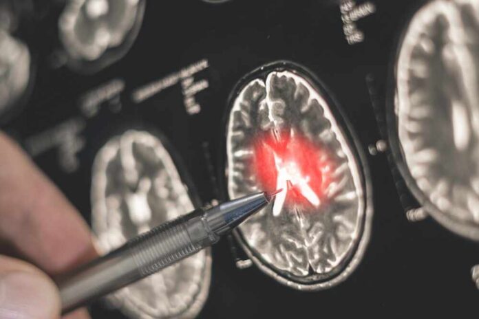Rare Gene Variant SLASHES Alzheimer’s Risk! | Health Insights